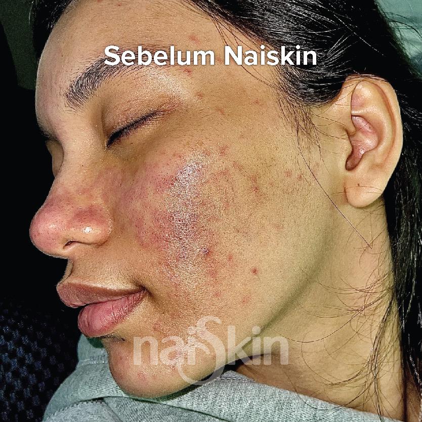 Naiskin, Online Shop | Shopee Malaysia
