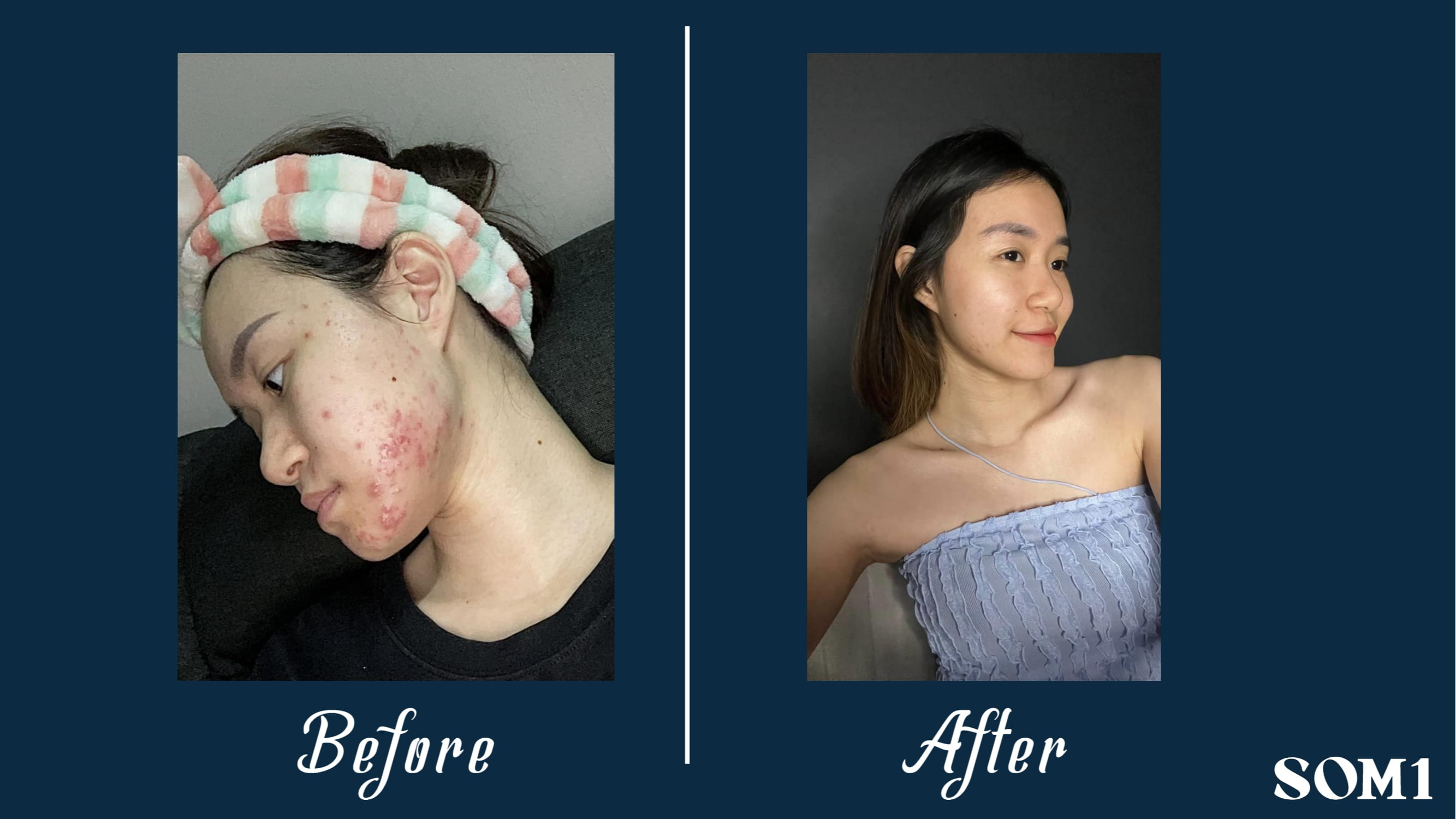 XMEGAMI OFFICIAL MISU MICAREE, Online Shop | Shopee Malaysia