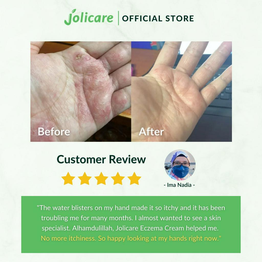 Jolicare™ Official Store, Online Shop | Shopee Malaysia