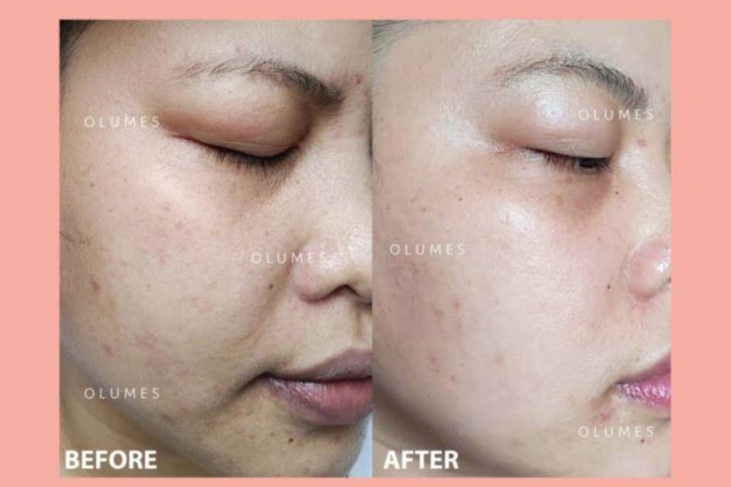 OLUMES Online, March 2026 | Shopee Malaysia