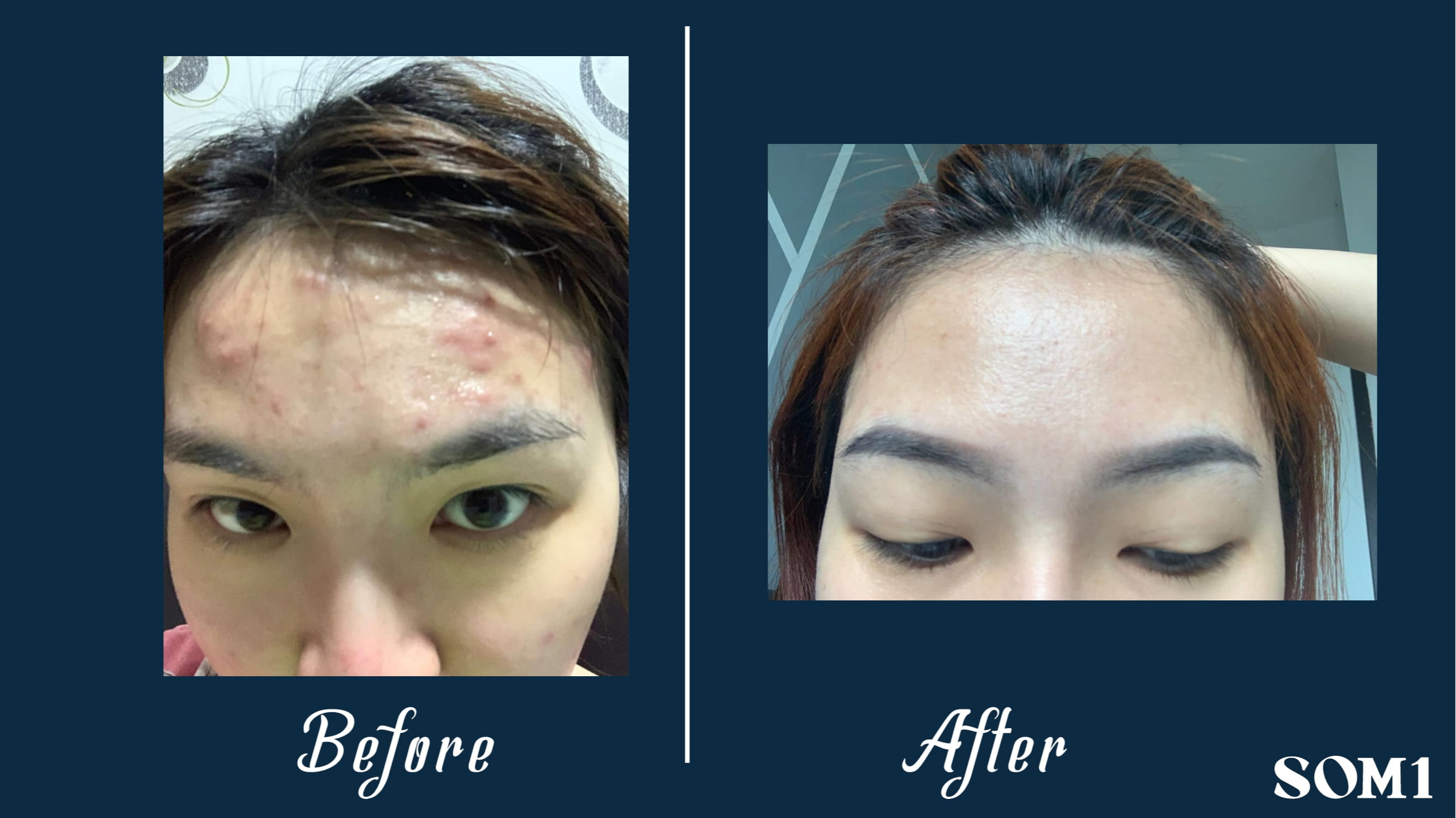 XMEGAMI OFFICIAL MISU MICAREE, Online Shop | Shopee Malaysia