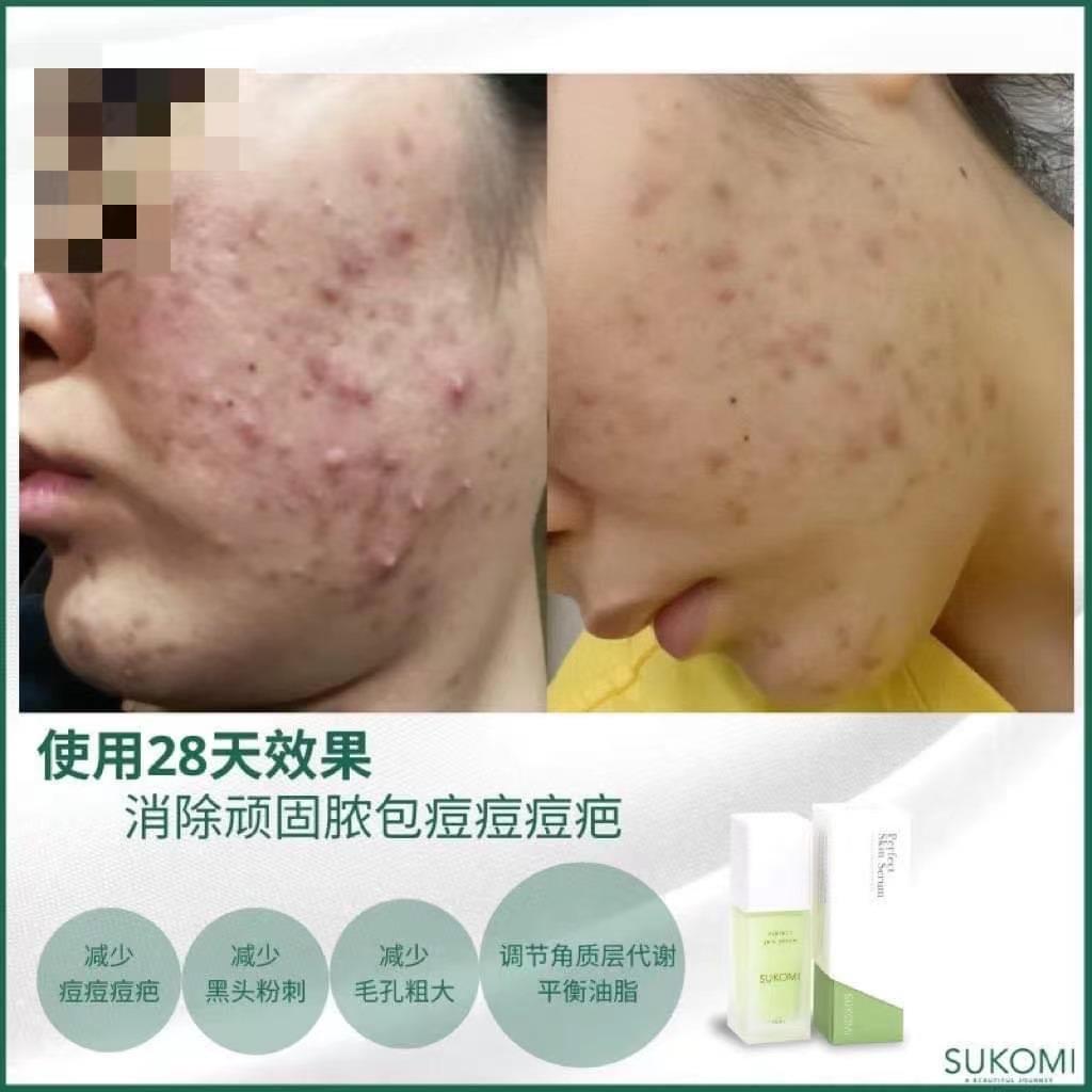 Sukomi.official, Online Shop | Shopee Malaysia