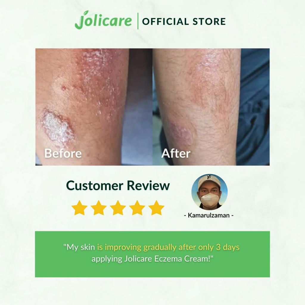 Jolicare™ Official Store, Online Shop | Shopee Malaysia