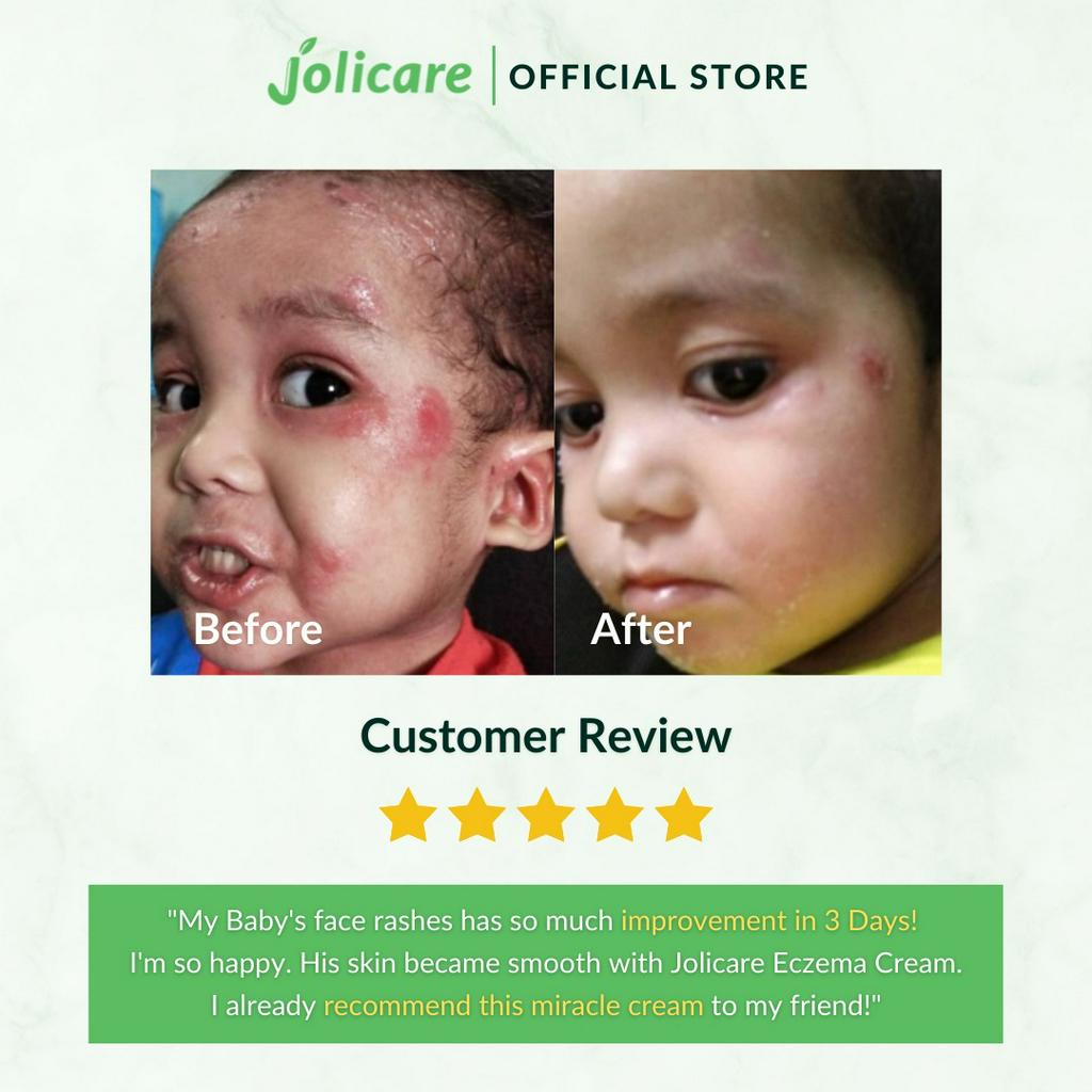 Jolicare™ Official Store, Online Shop | Shopee Malaysia