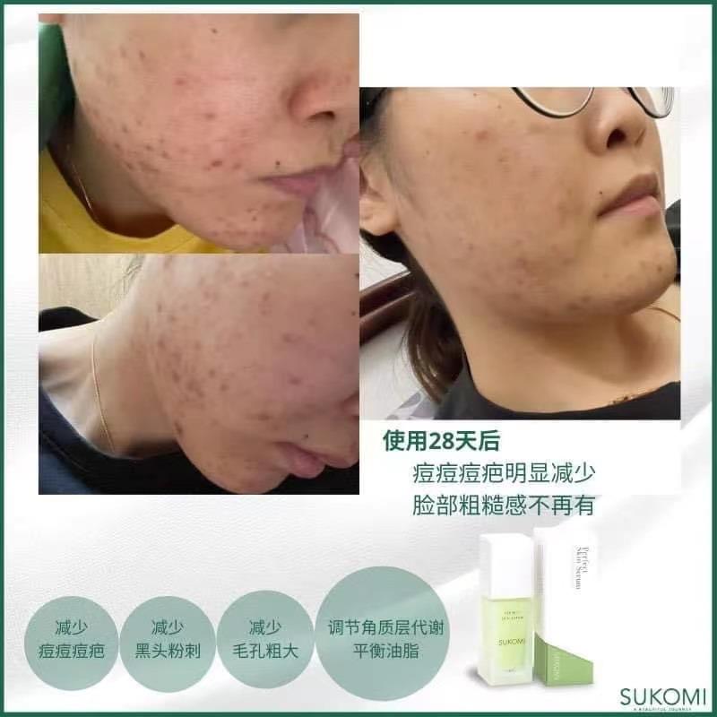 Sukomi.official, Online Shop | Shopee Malaysia