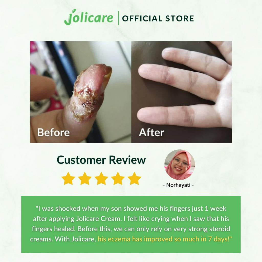 Jolicare™ Official Store, Online Shop | Shopee Malaysia