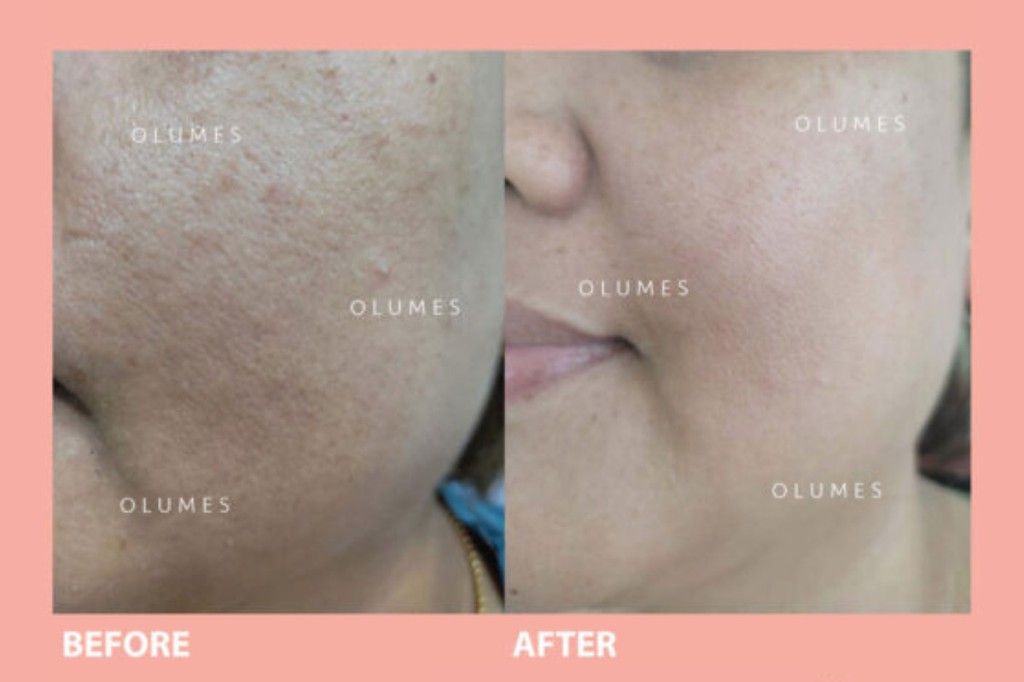 OLUMES, Online Shop | Shopee Malaysia