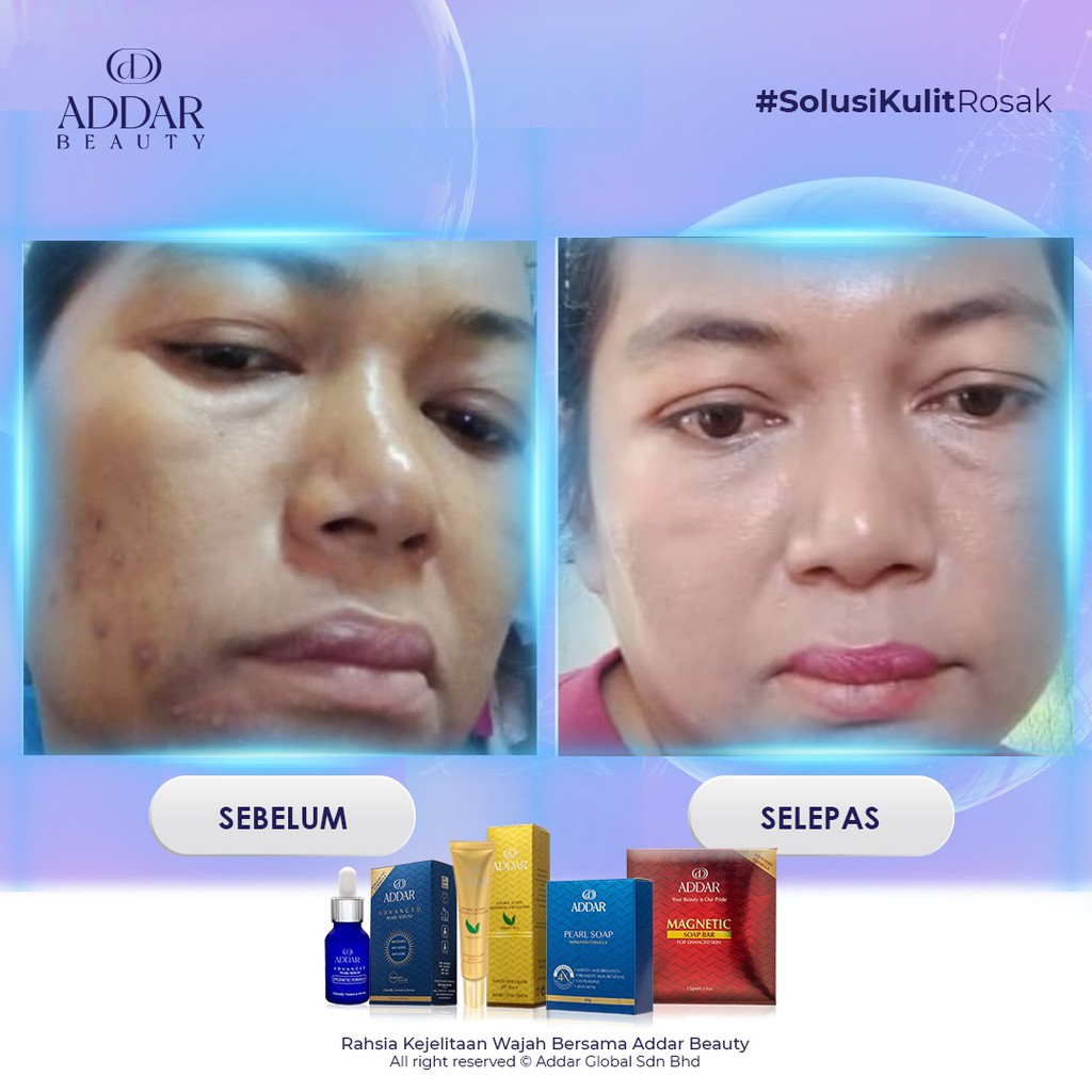 AdDar Beauty MY Official Store, Online Shop | Shopee Malaysia