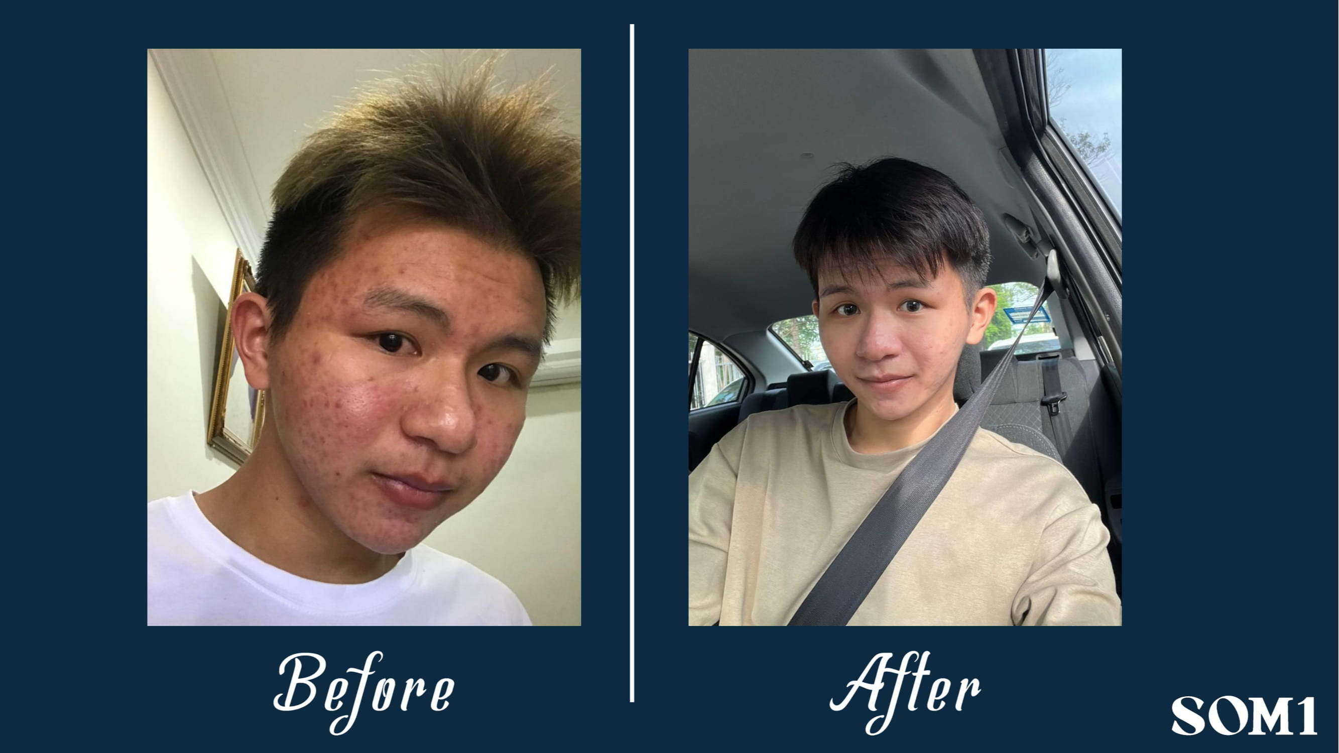 XMEGAMI OFFICIAL MISU MICAREE, Online Shop | Shopee Malaysia