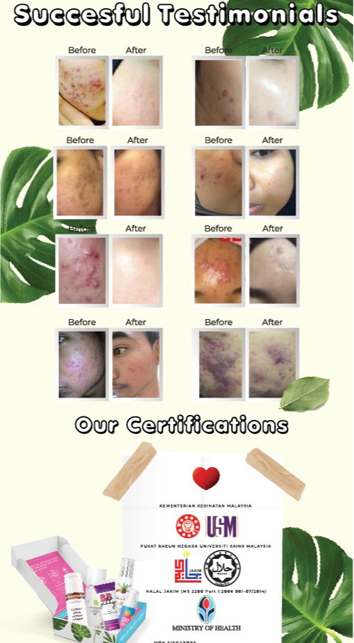 lovera_malaysia, Online Shop | Shopee Malaysia