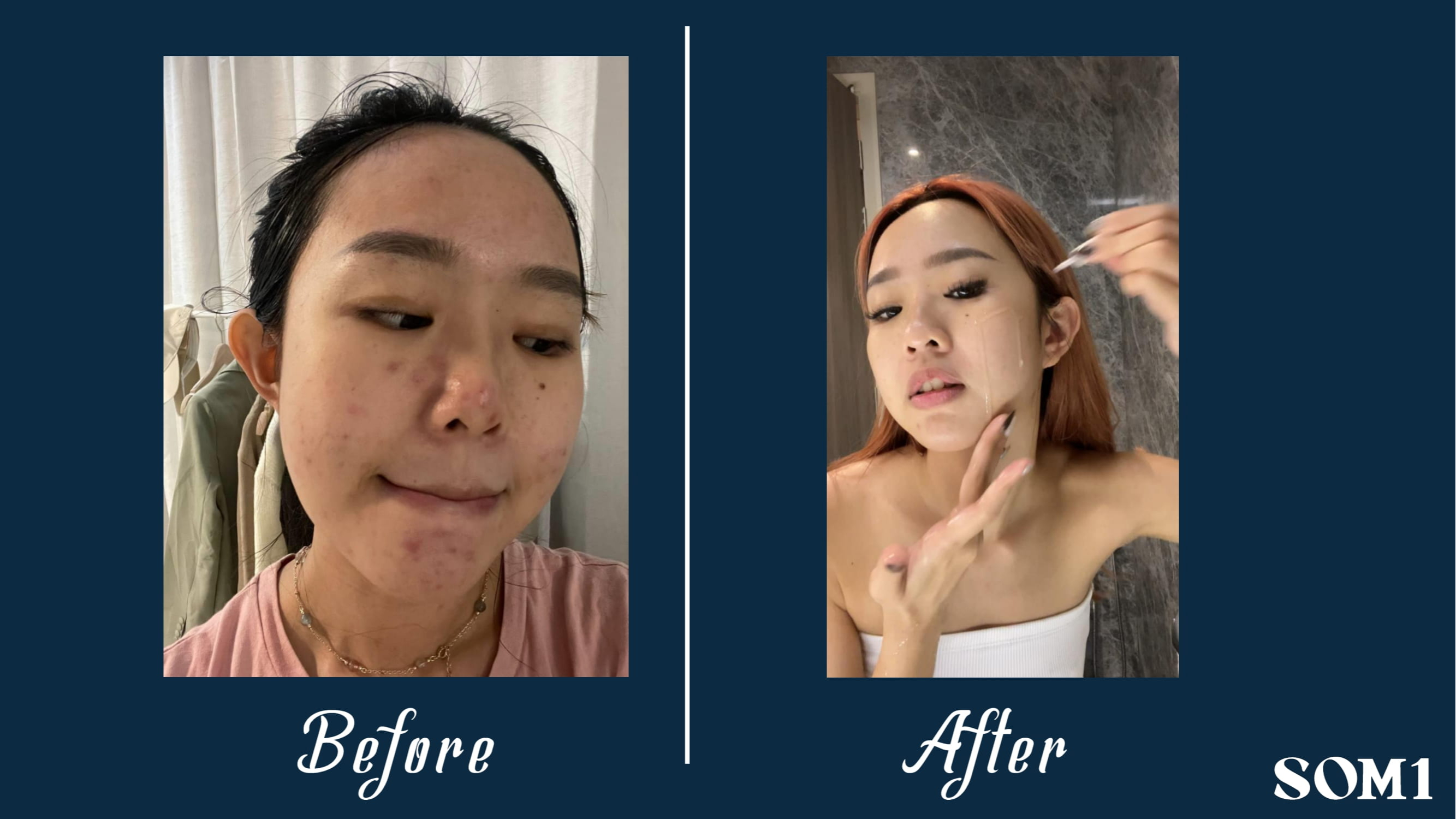 XMEGAMI OFFICIAL MISU MICAREE, Online Shop | Shopee Malaysia