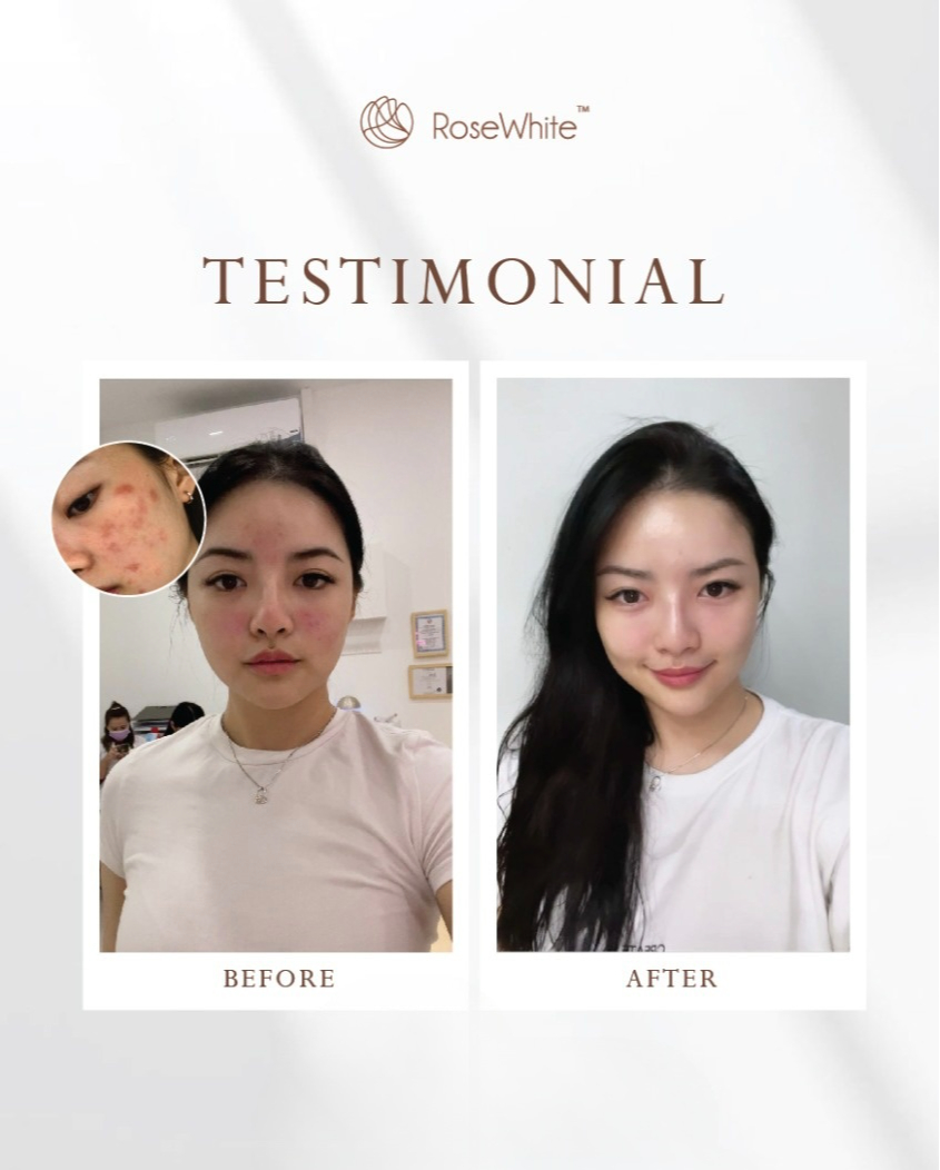 Rosewhite Official Store, Online Shop | Shopee Malaysia